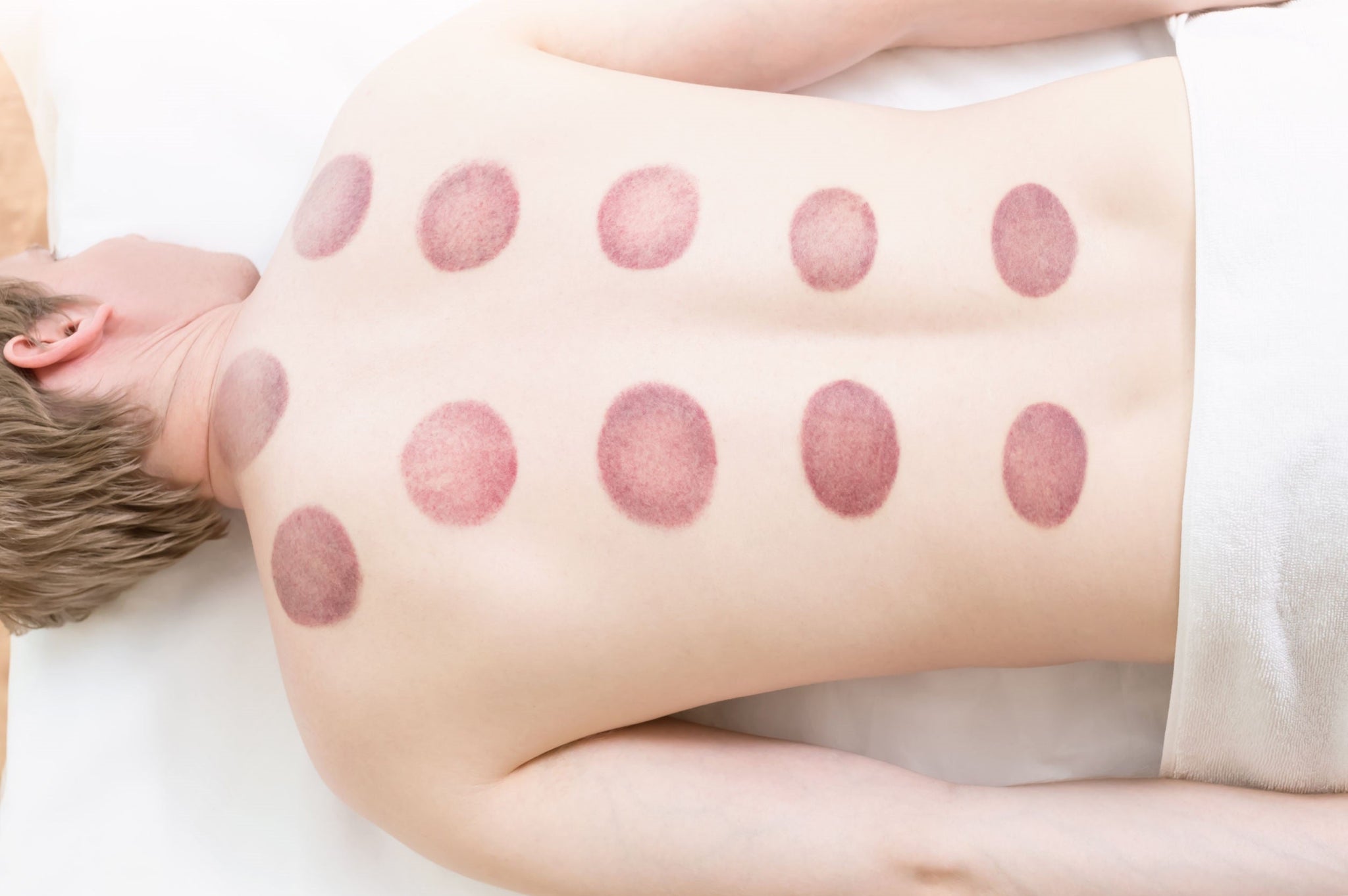 Self-paced Online Home Study 12 CE Orthopedic Cupping | CE Institute LLC
